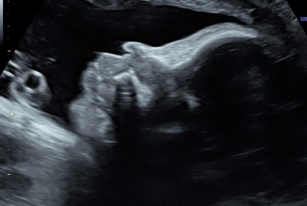 Ultrassom Obstétrico - Clínica Origem
