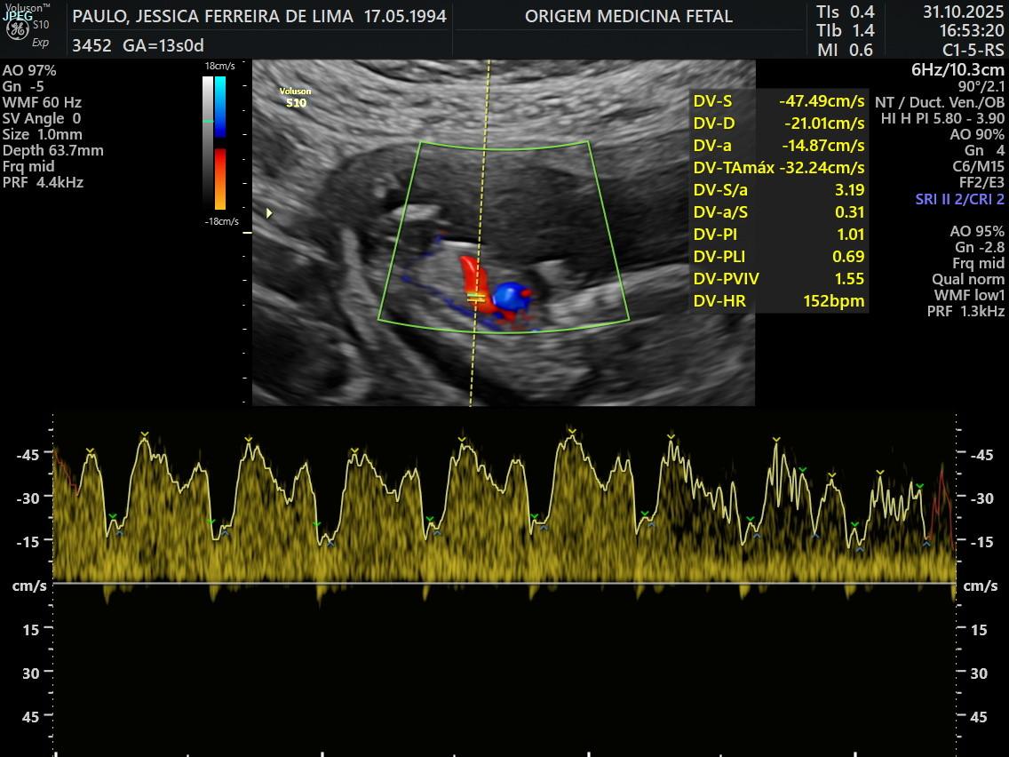 Ultrassom Obstétrico com Doppler: quando é necessário? | Clínica Origem