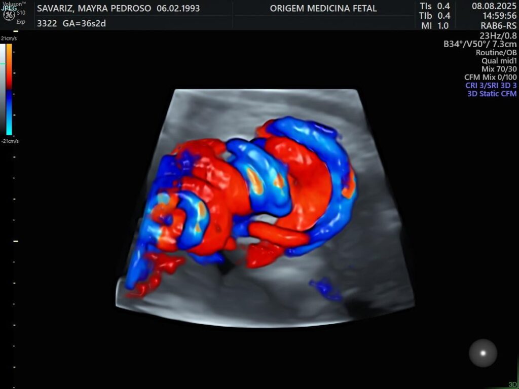 Ultrassom Obstétrico com Doppler: quando é necessário? | Clínica Origem